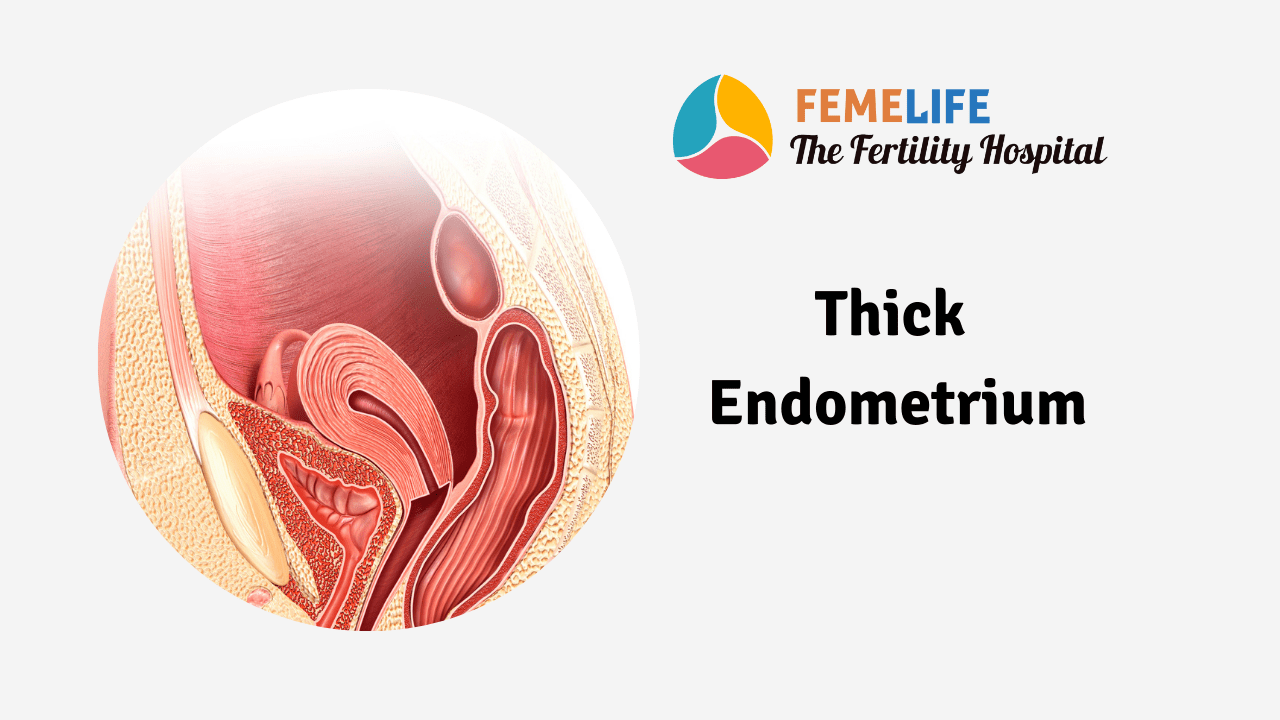 Thick Endometrium Effects On Pregnancy IVF FEMELIFE